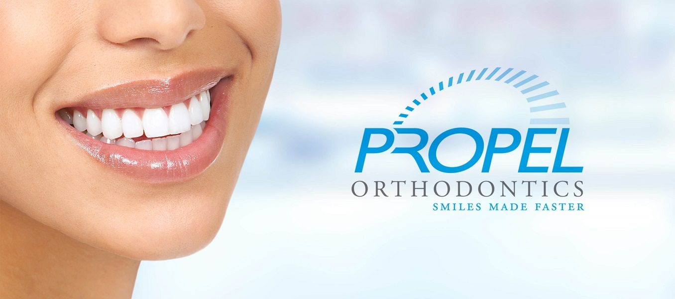 Propel in Avon, Sandusky, Wadsworth, OH | A&A Orthodontics